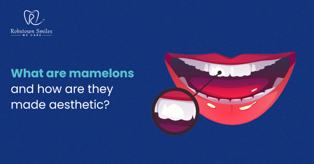 What Are Mamelons & How Are They Made Aesthetic | Robstown Smiles
